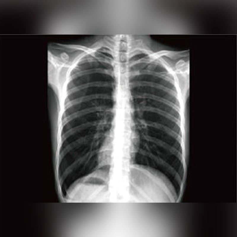 Durable 1-Screen X-Ray Film Viewer Sale or Rent Near Me – Goldstar ...