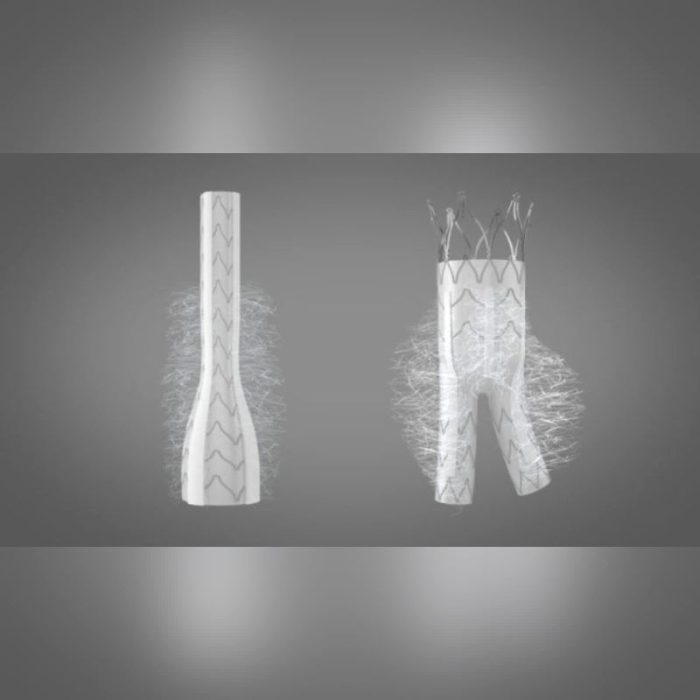 Durable Abdominal Aorta Vascular Prosthesis Sale or Rent Near Me ...