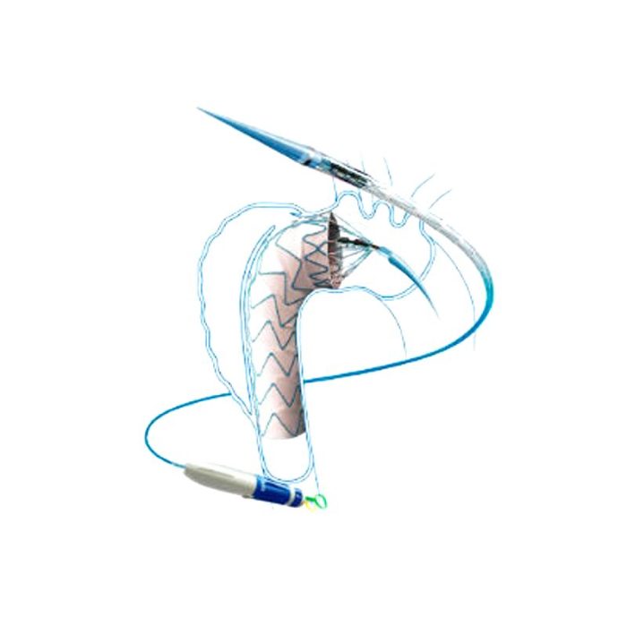 Durable Ascending Thoracic Aorta Stent Graft Sale or Rent Near Me ...