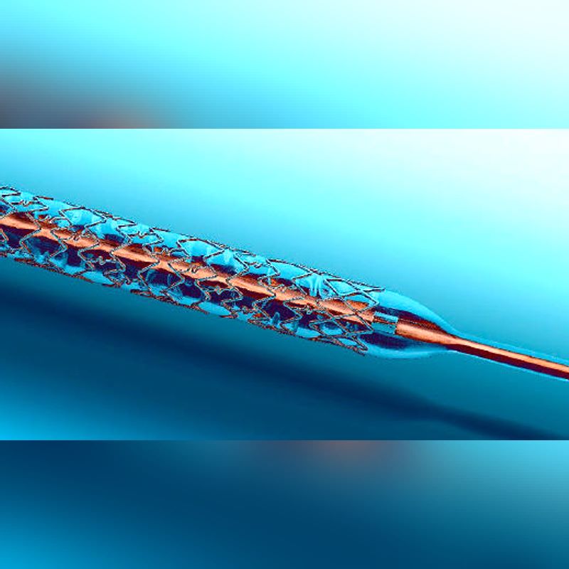 Durable Coronary Stent Sale or Rent Near Me – Goldstar Medical ...