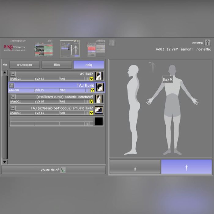 Durable Cr Scanner Sale or Rent Near Me – Goldstar Medical Equipment ...