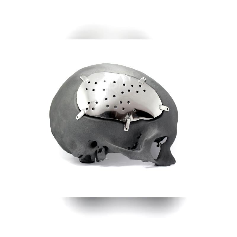 Durable Custom-Made Cranial Implant Sale or Rent Near Me – Goldstar ...