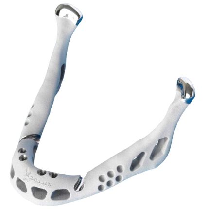 Durable Custom-Made Mandibular Implant Sale or Rent Near Me – Goldstar ...