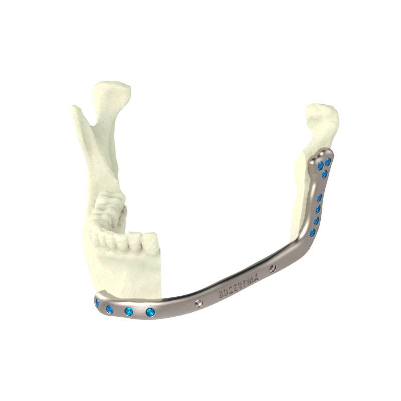 Durable Custom-Made Mandibular Implant Sale or Rent Near Me – Goldstar ...