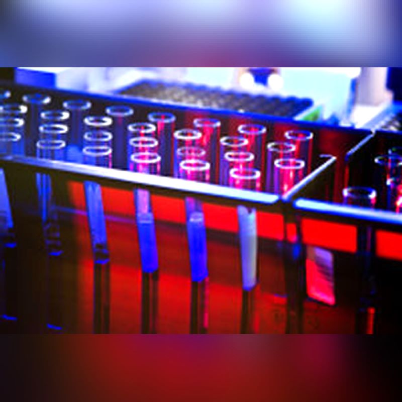 Durable Endotoxin Testing Laboratory Automation System Sale or Rent ...