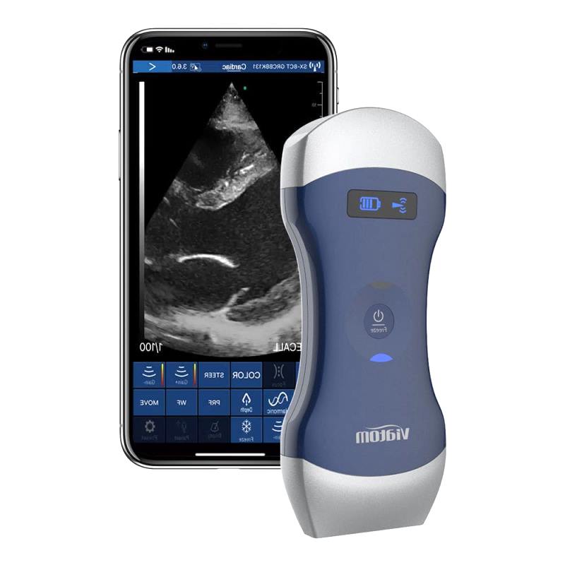 Durable Hand-Held Ultrasound System Sale or Rent Near Me – Goldstar ...