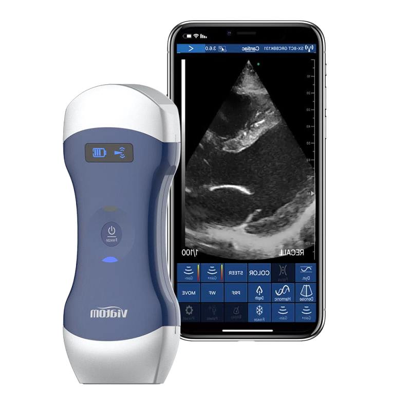 Durable Hand-Held Ultrasound System Sale or Rent Near Me – Goldstar ...