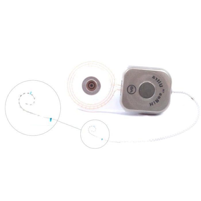 Durable Internal Component Cochlear Implant Sale or Rent Near Me ...