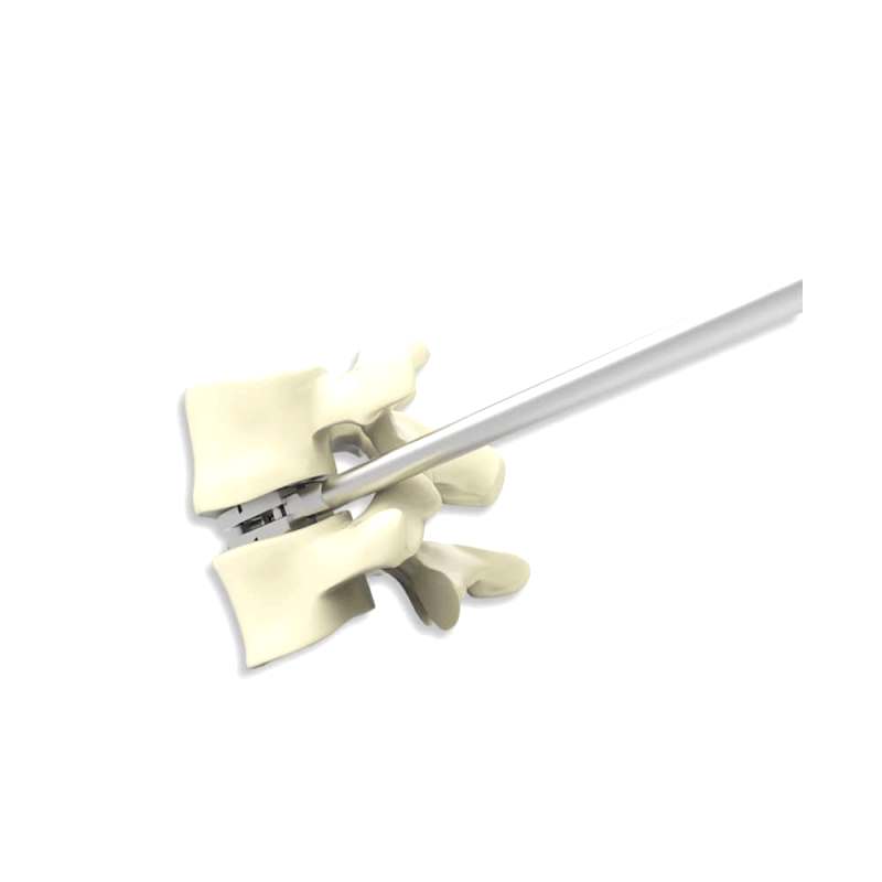 Durable Cervical Interbody Fusion Cage Sale or Rent Near Me – Goldstar Medical Equipment Store ...