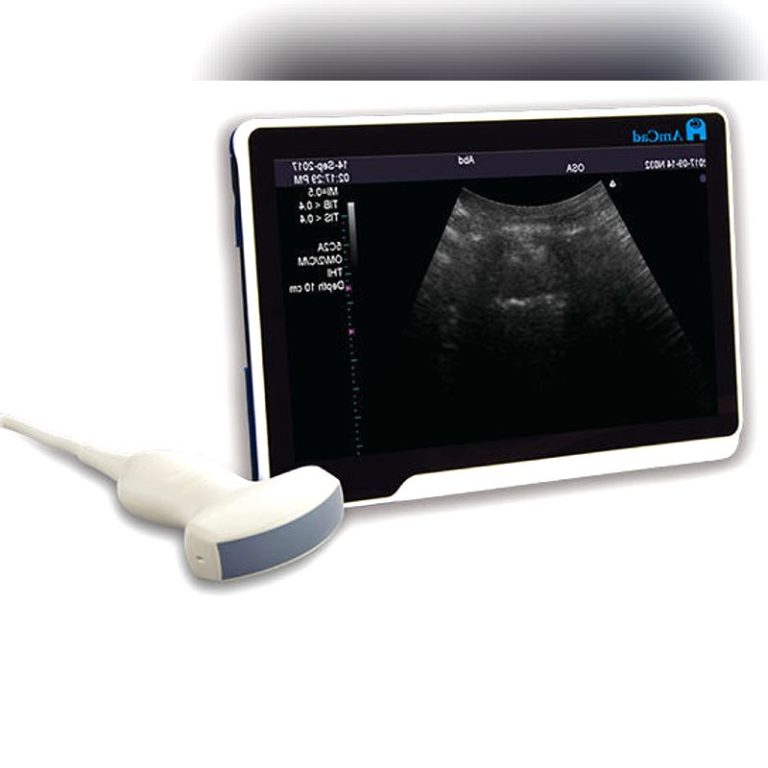 Durable Obstructive Sleep Apnea Detection Remote-Controlled Ultrasound ...