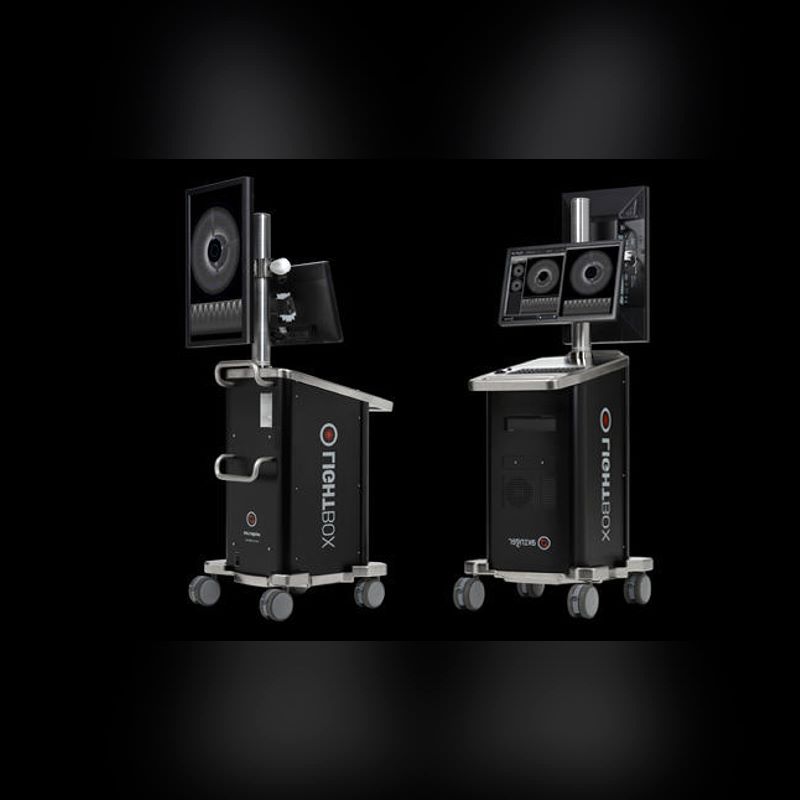 Durable Oct Endoscopic Imaging System Sale or Rent Near Me – Goldstar ...