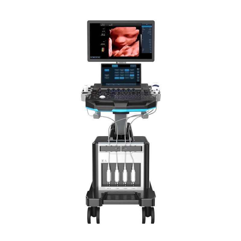 Durable Portable Ultrasound System Sale or Rent Near Me – Goldstar ...