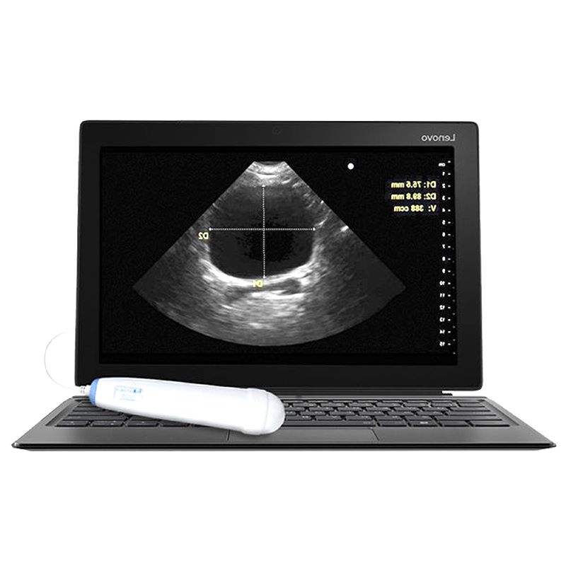 Durable Portable Bladder Scanner Sale or Rent Near Me – Goldstar ...