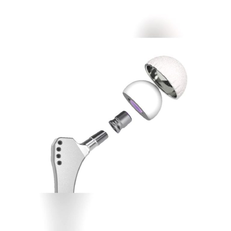 Durable Revision Acetabular Prosthesis Sale or Rent Near Me – Goldstar ...