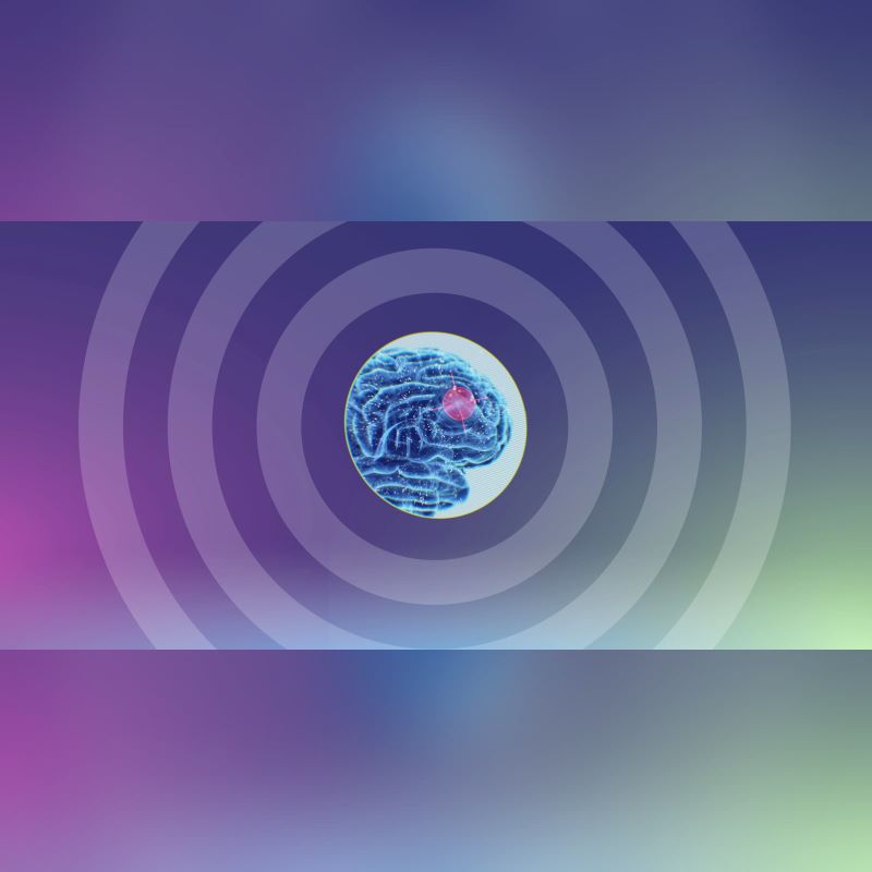 Durable Tms Neuronavigation System Sale or Rent Near Me – Goldstar ...