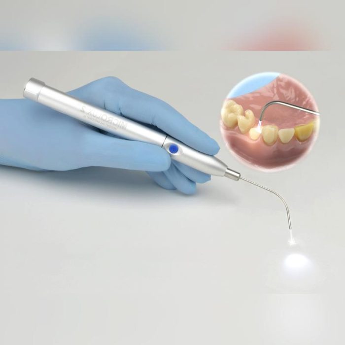 Durable Transillumination Caries Detector Sale or Rent Near Me ...