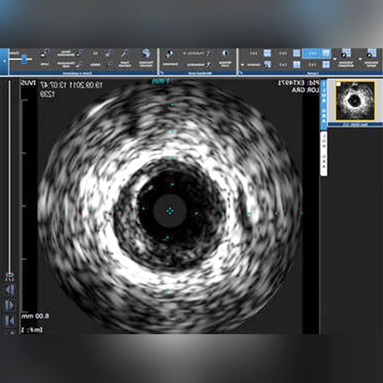 Durable Vascular Examination Software Sale or Rent Near Me – Goldstar ...