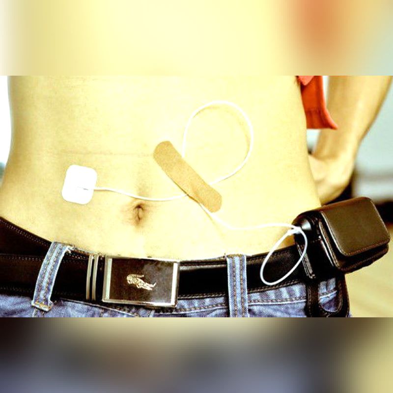 Durable Waterproof Insulin Pump Sale or Rent Near Me – Goldstar Medical ...
