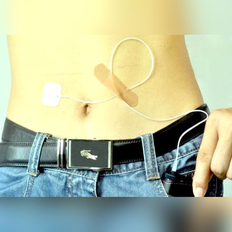 Durable Waterproof Insulin Pump Sale or Rent Near Me – Goldstar Medical ...